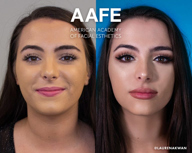 AAFE Smooth PDO Threads Live Virtual Training - AAFE - American Academy ...